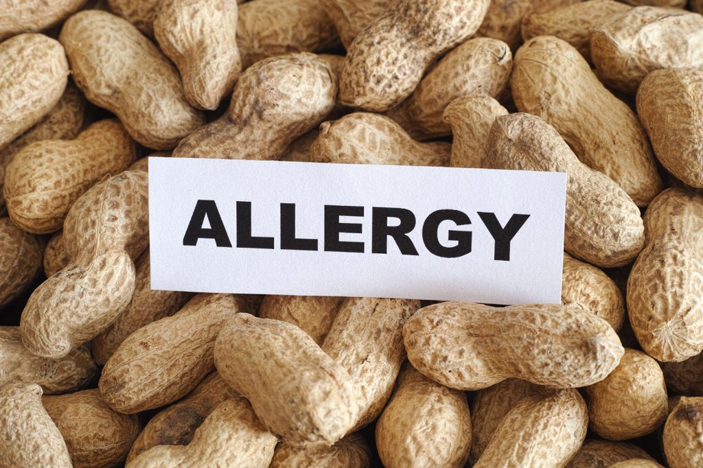 Allergy Information - Jenno's Coffee House